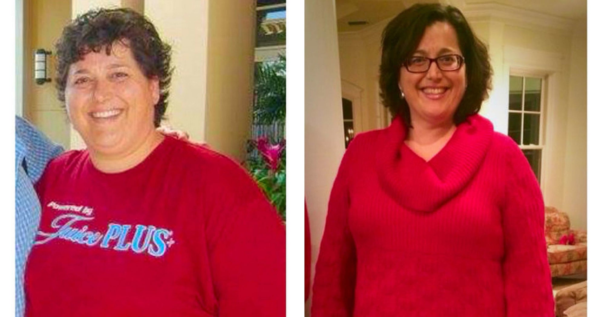 After a Failed LapBand Surgery, I Went On a Plant-Based Diet and Got ...